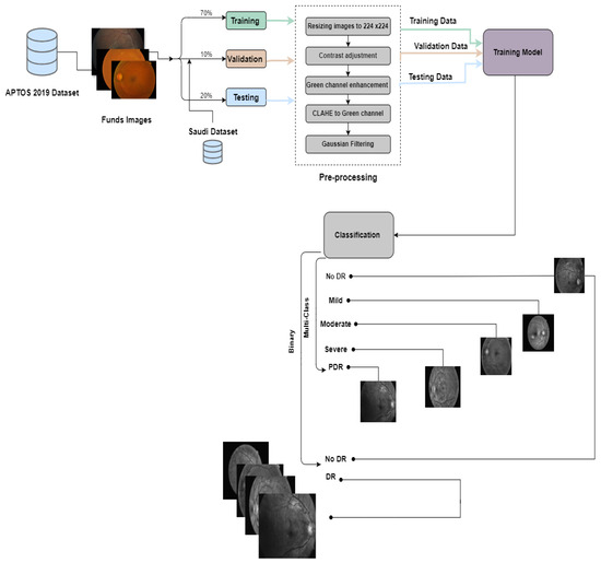 Early Detection and Classification of Diabetic Retinopathy: A Deep ...