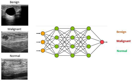 FPGA Hardware Acceleration of AI Models for Real-Time Breast Cancer ...
