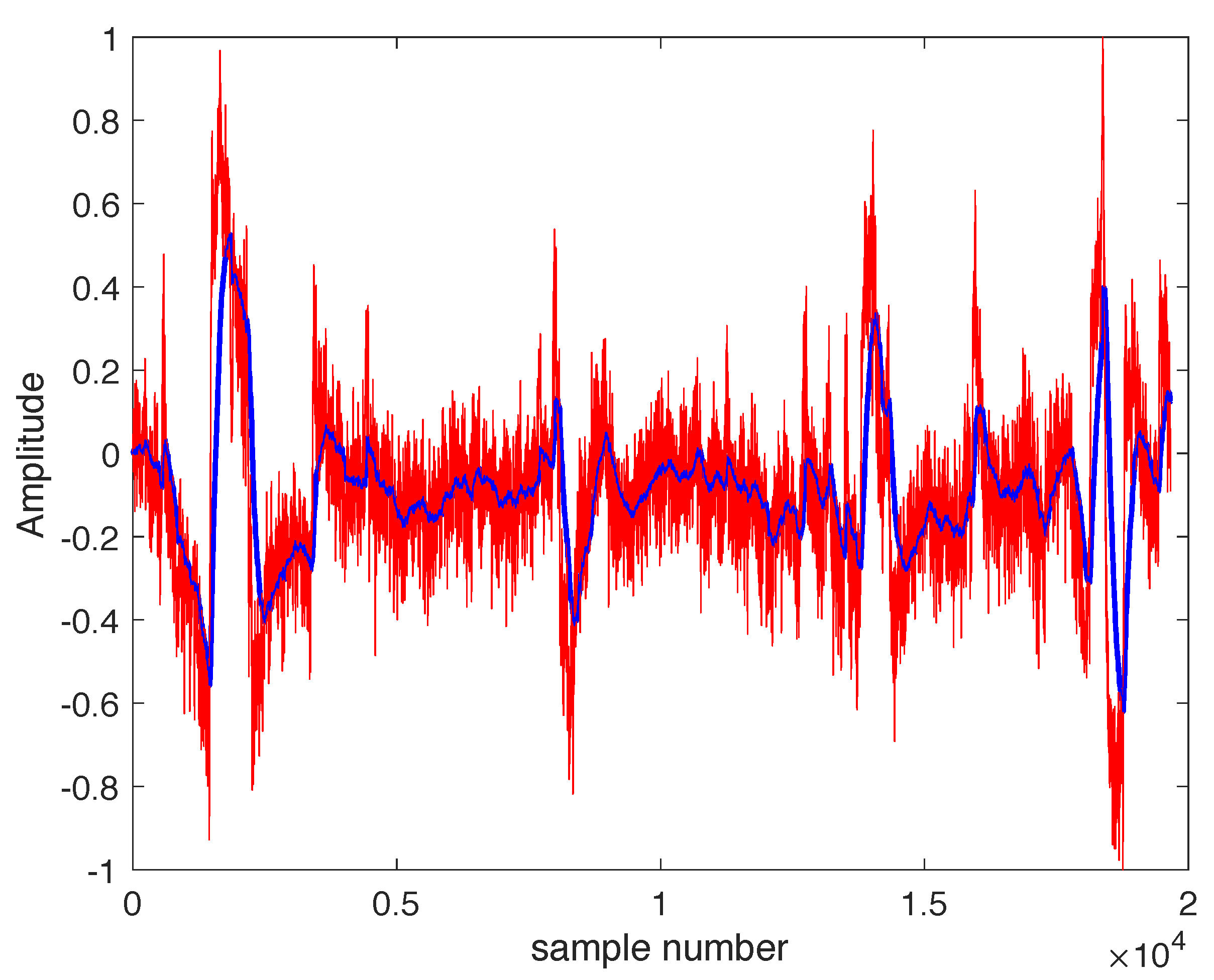Non-Linear Synthetic Time Series Generation for Electroencephalogram ...