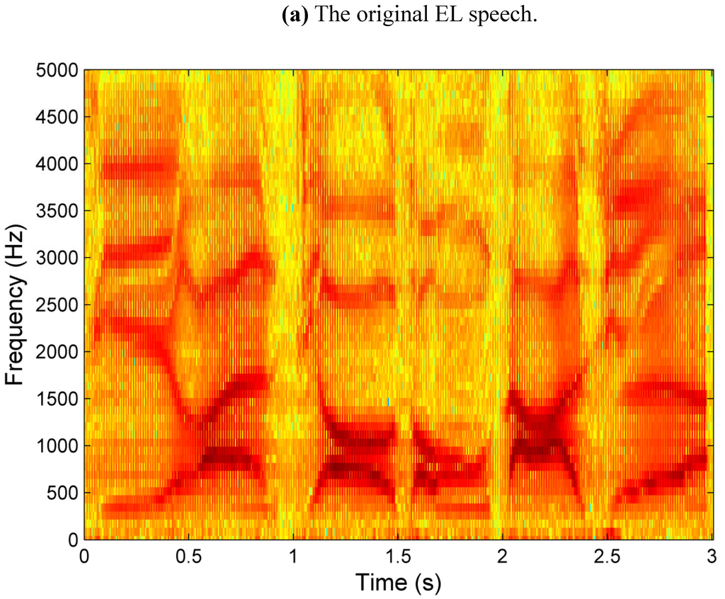 Multi-Band Spectral Subtraction Method for Electrolarynx Speech Enhancement