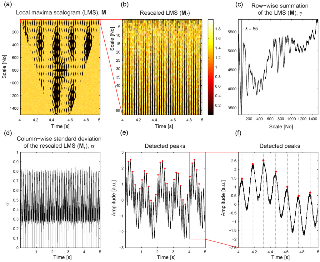 An Efficient Algorithm For Automatic Peak Detection In Noisy Periodic And Quasi Periodic Signals