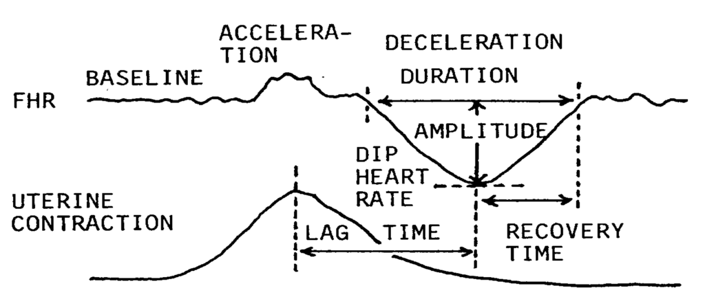 Algorithms | Free Full-Text | Algorithms for Computerized Fetal Heart ...