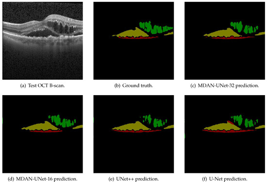 Algorithms | Free Full-Text | MDAN-UNet: Multi-Scale and Dual Attention Enhanced Nested U-Net ...