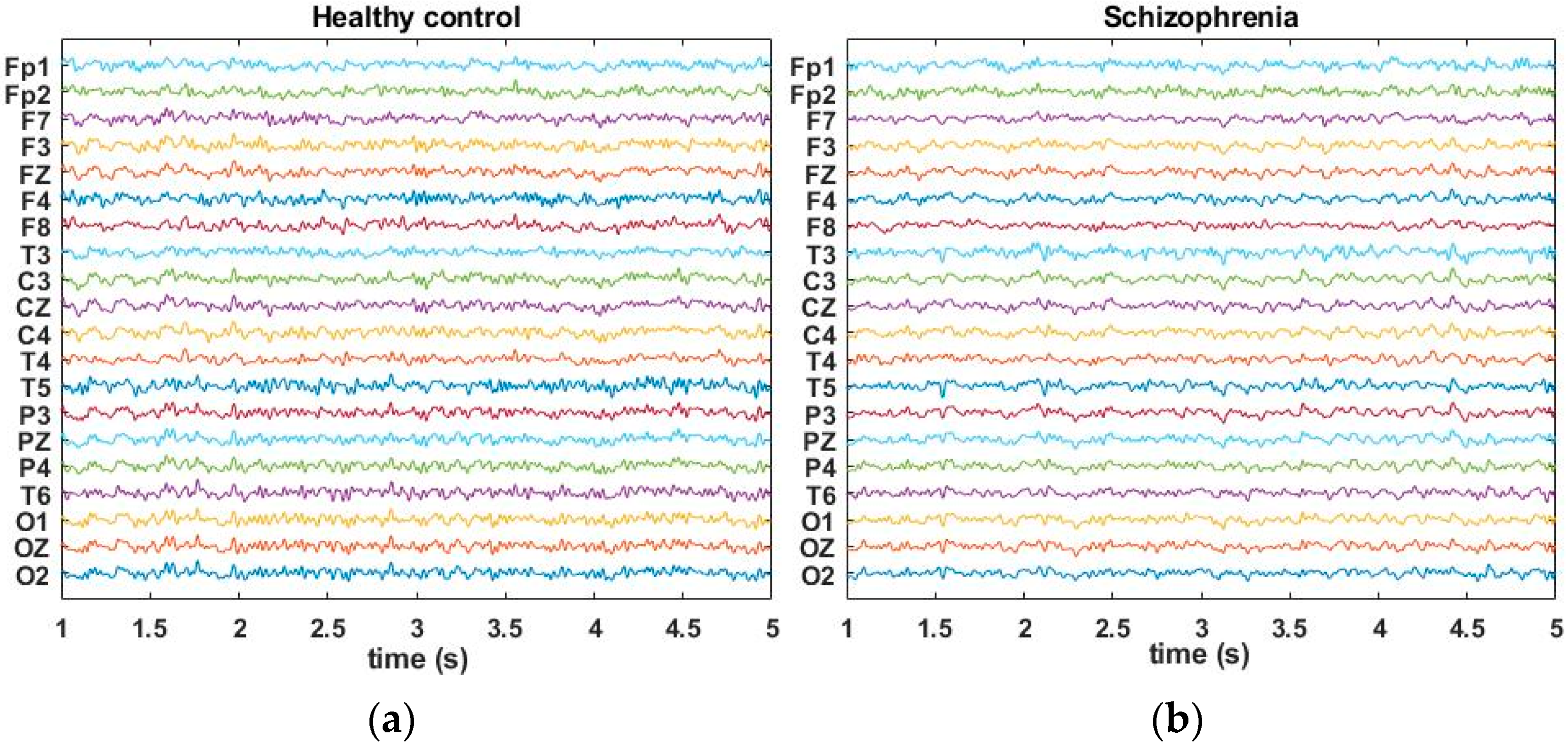 Algorithms Free Full Text Diagnosing Schizophrenia Using Effective Connectivity Of Resting