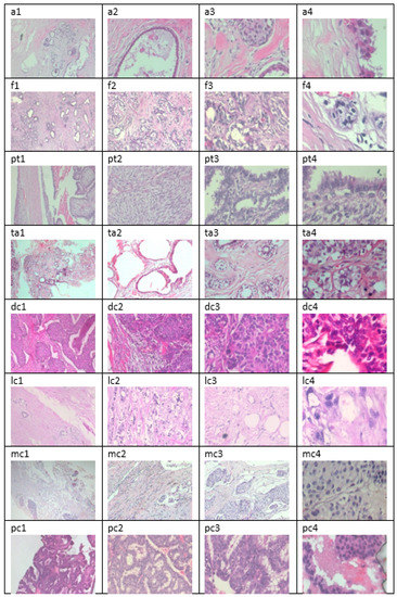 Algorithms | Free Full-Text | Ensembling EfficientNets for the Classification and Interpretation ...