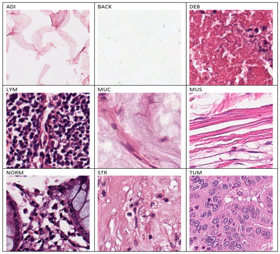 Algorithms | Free Full-Text | Ensembling EfficientNets for the Classification and Interpretation ...