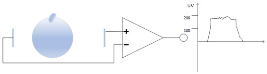 Eye Fatigue Detection through Machine Learning Based on Single Channel ...