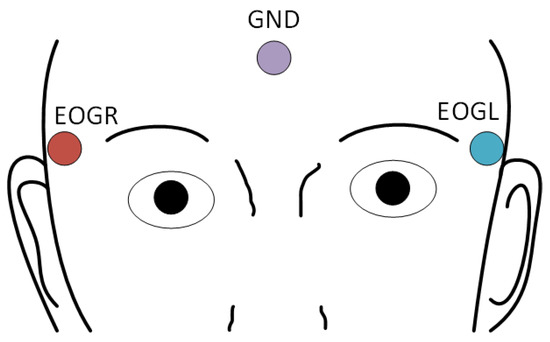 Eye Fatigue Detection through Machine Learning Based on Single Channel ...