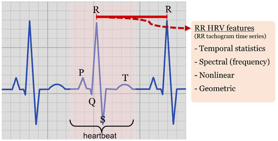 Automatic Atrial Fibrillation Arrhythmia Detection Using Univariate and ...
