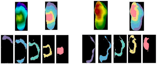 Algorithms Special Issue Algorithms For Machine Learning And Pattern Recognition Tasks