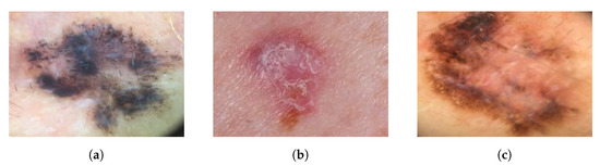 Algorithms | Free Full-Text | Machine Learning Approaches for Skin ...