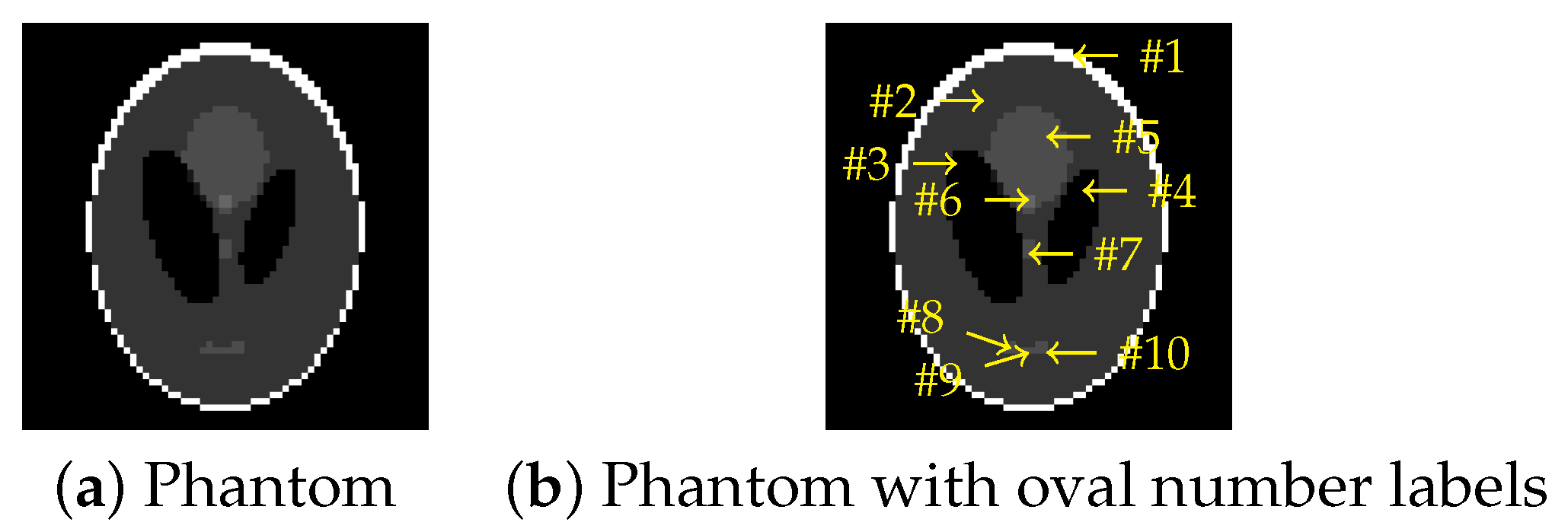 Iterative Image Reconstruction Algorithm with Parameter Estimation by ...