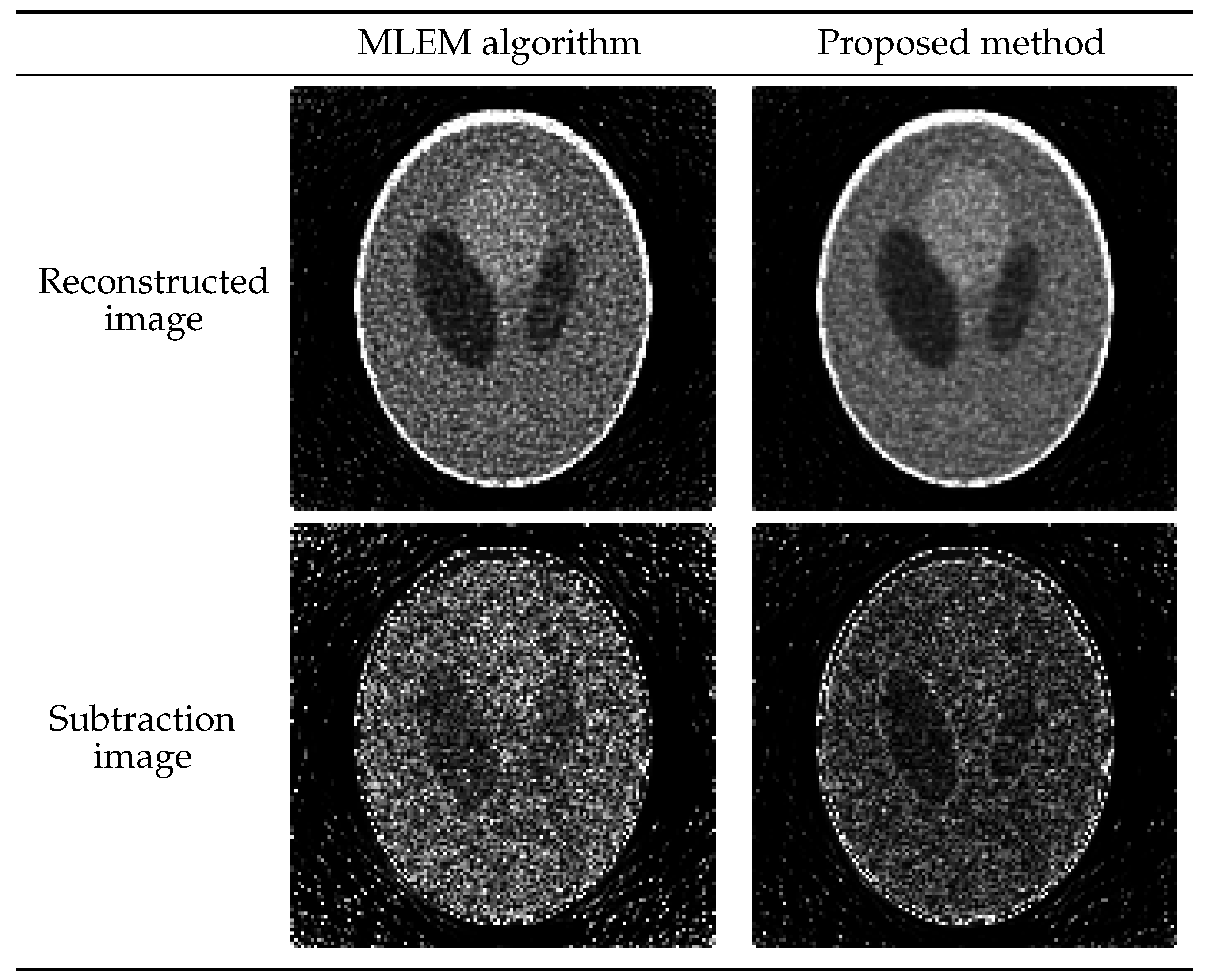 Iterative Image Reconstruction Algorithm With Parameter Estimation By Neural Network For