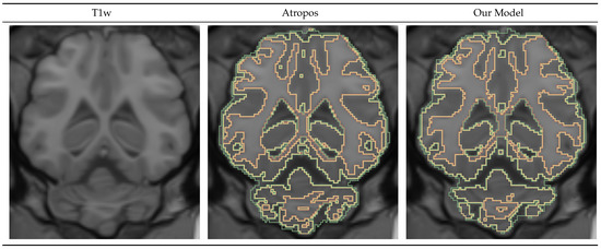 PigSNIPE: Scalable Neuroimaging Processing Engine for Minipig MRI