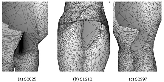 Human Body Shapes Anomaly Detection and Classification Using Persistent ...
