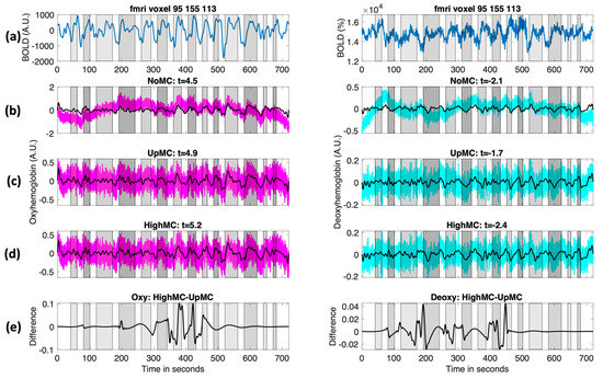 An Automatic Motion-Based Artifact Reduction Algorithm for fNIRS in Concurrent Functional ...