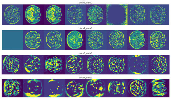 Ensemble Transfer Learning for Distinguishing Cognitively Normal and ...