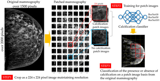 Algorithms Free Full Text Development Of A Mammography