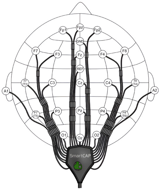 Automating Stimulation Frequency Selection for SSVEP-Based Brain-Computer Interfaces