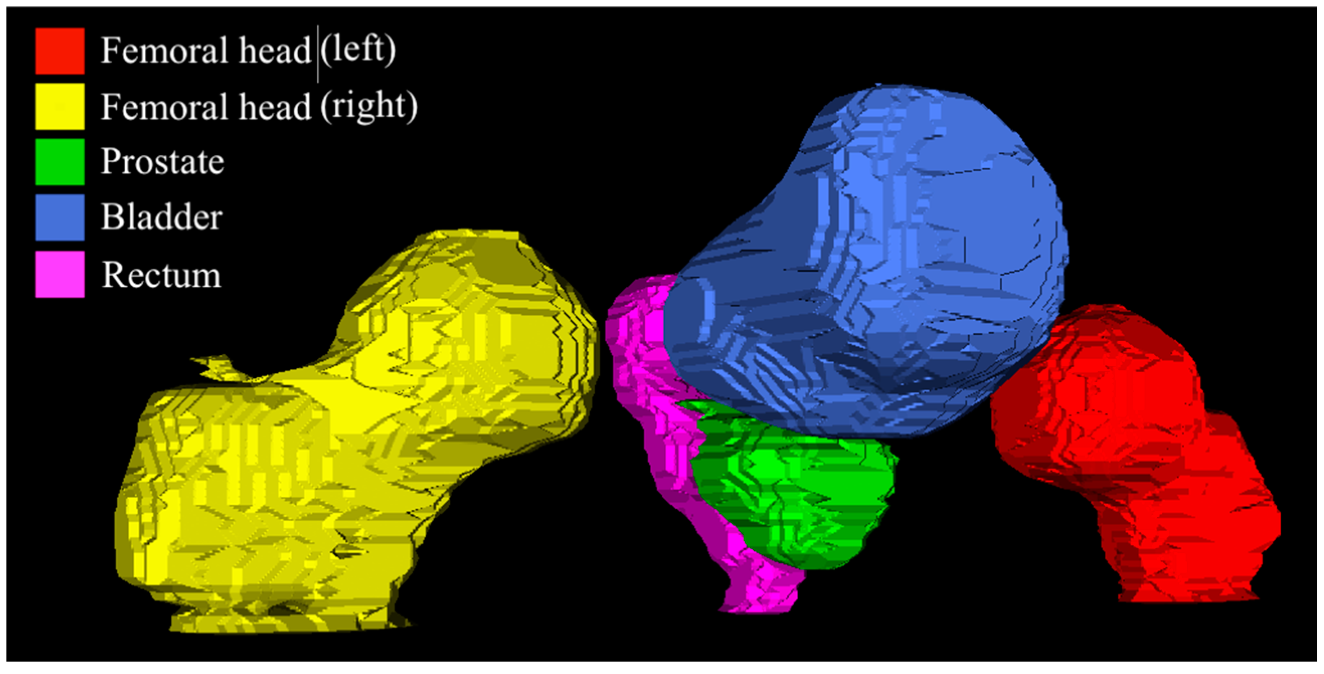 Automatic Multiorgan Segmentation In Pelvic Region With Convolutional Neural Networks On 035 T
