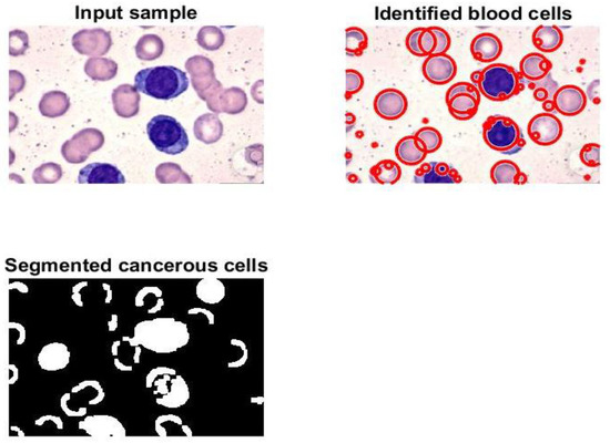 A Novel Deep Learning Segmentation and Classification Framework for ...