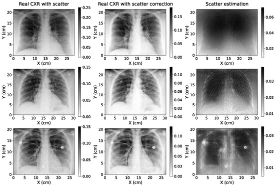 Robustness of Single- and Dual-Energy Deep-Learning-Based Scatter Correction Models on Simulated ...