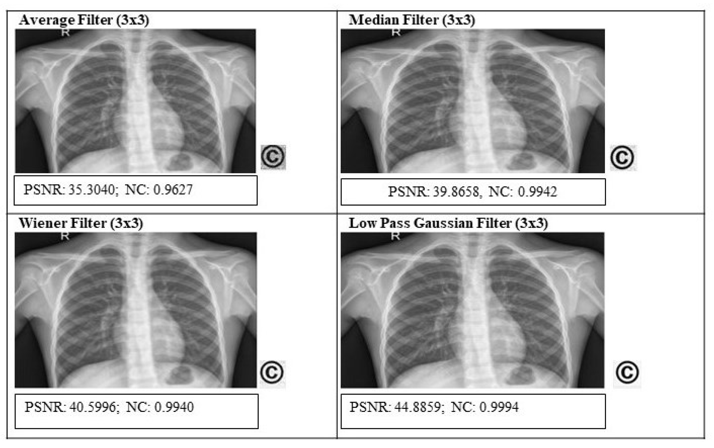 Algorithms | Free Full-Text | Image Watermarking Using Discrete Wavelet Transform and Singular ...