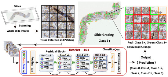 Deep Neural Networks for HER2 Grading of Whole Slide Images with ...