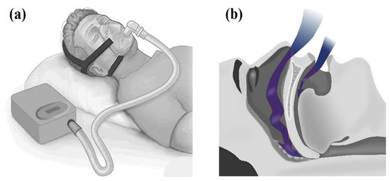 Algorithms | Free Full-Text | Artificial Intelligence-Based Algorithms ...