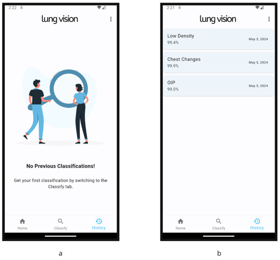 LungVision: X-ray Imagery Classification for On-Edge Diagnosis Applications