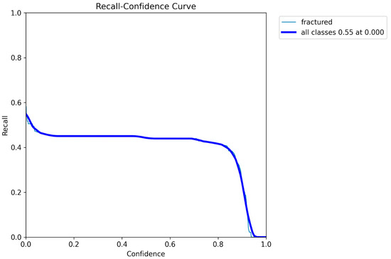 Deep Learning Approach for Arm Fracture Detection Based on an Improved YOLOv8 Algorithm