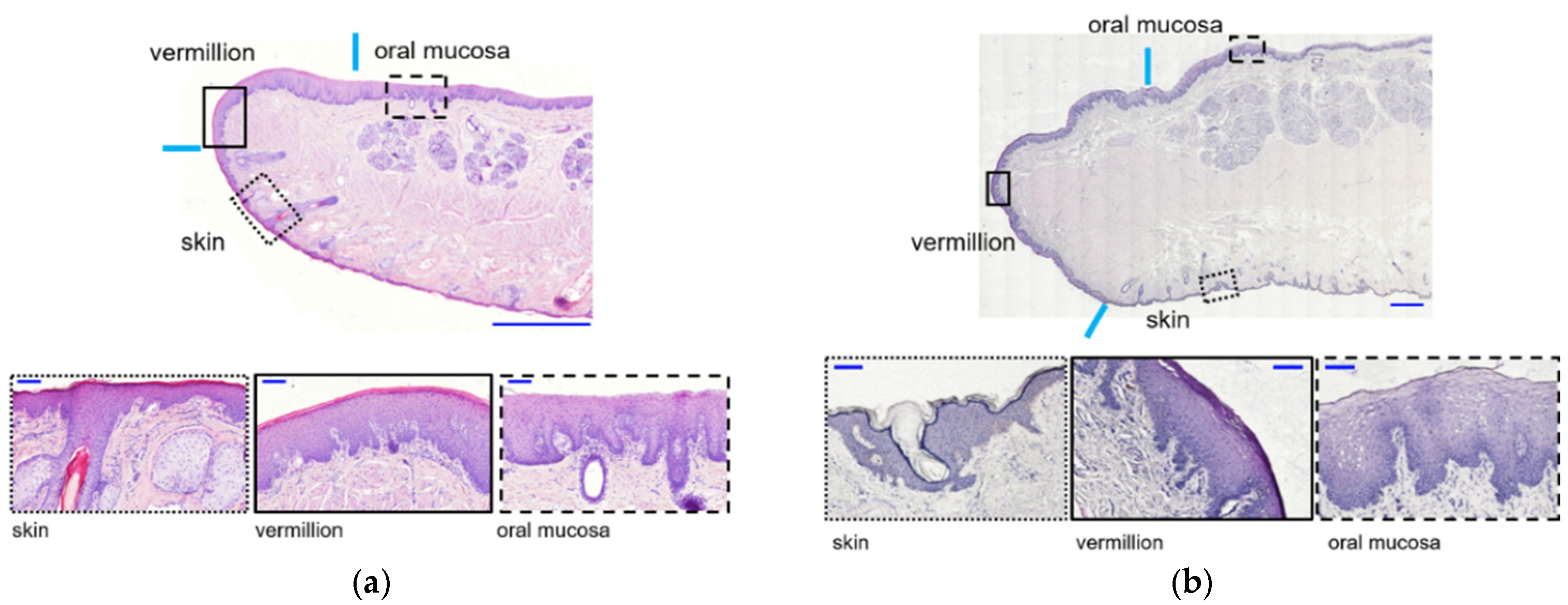 Lip Anatomy Histology at Wallace Swindler blog