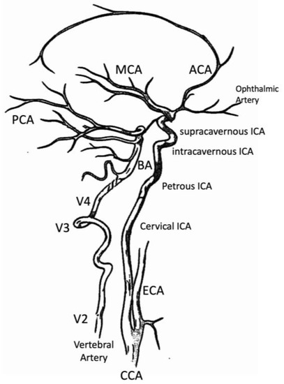 Anatomia | Free Full-Text | Anatomy of Cerebral Arteries with Clinical ...