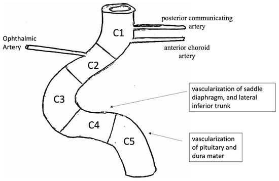 Anatomy of Cerebral Arteries with Clinical Aspects in Patients with ...