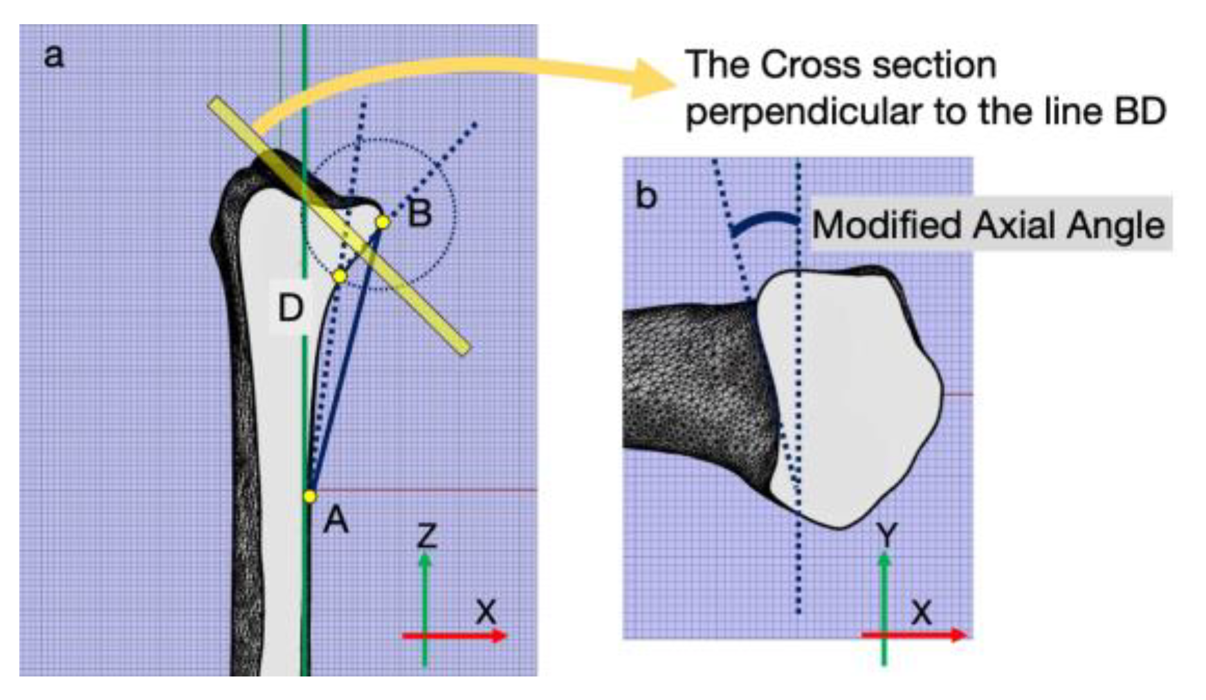 Anatomia Free Full Text Do Anatomical Differences Of The Volar Rim