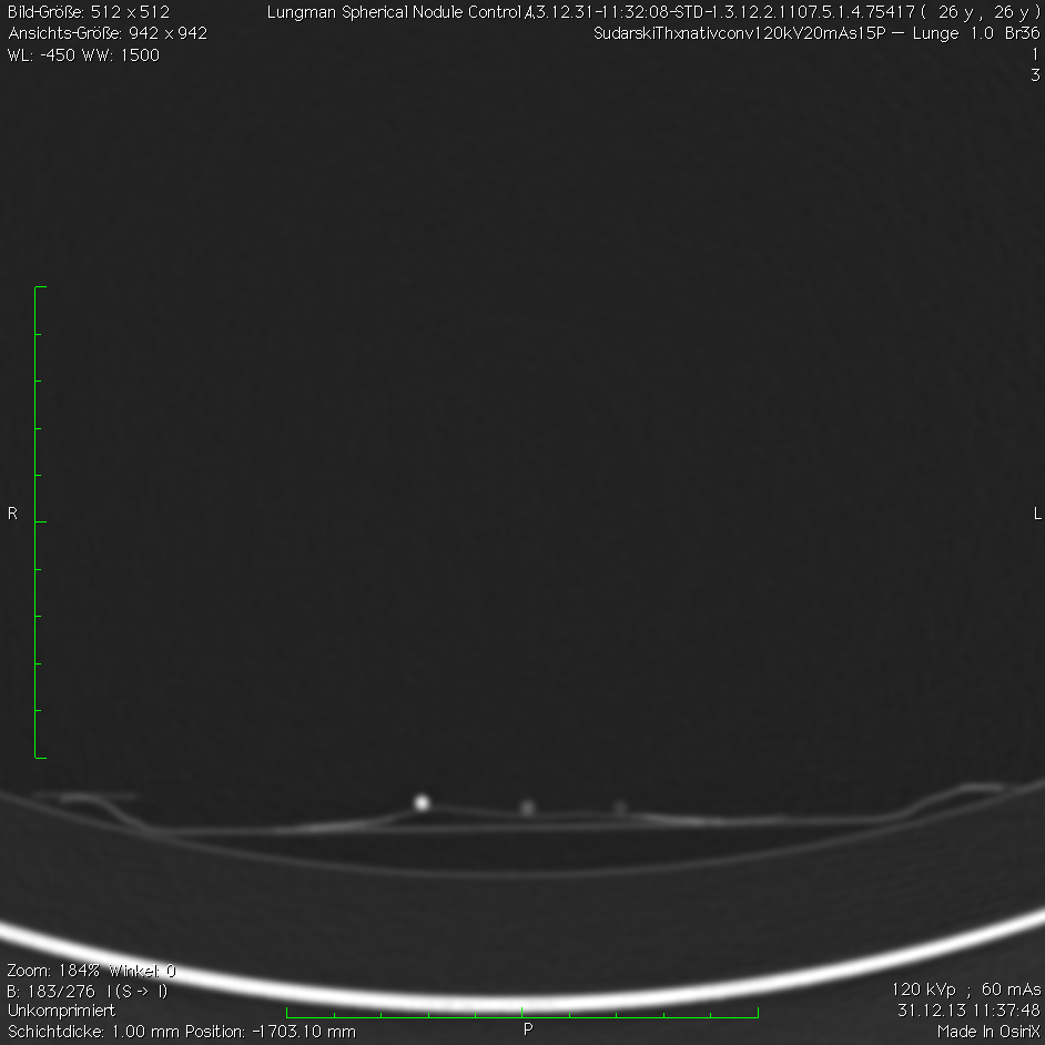 Observer Sensitivity for Detection of Pulmonary Nodules in Ultra-Low ...