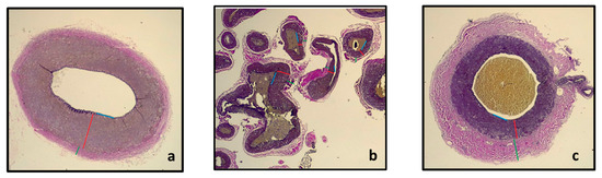 The Rostral Epidural Rete Mirabile: Functional Significance in Blood ...