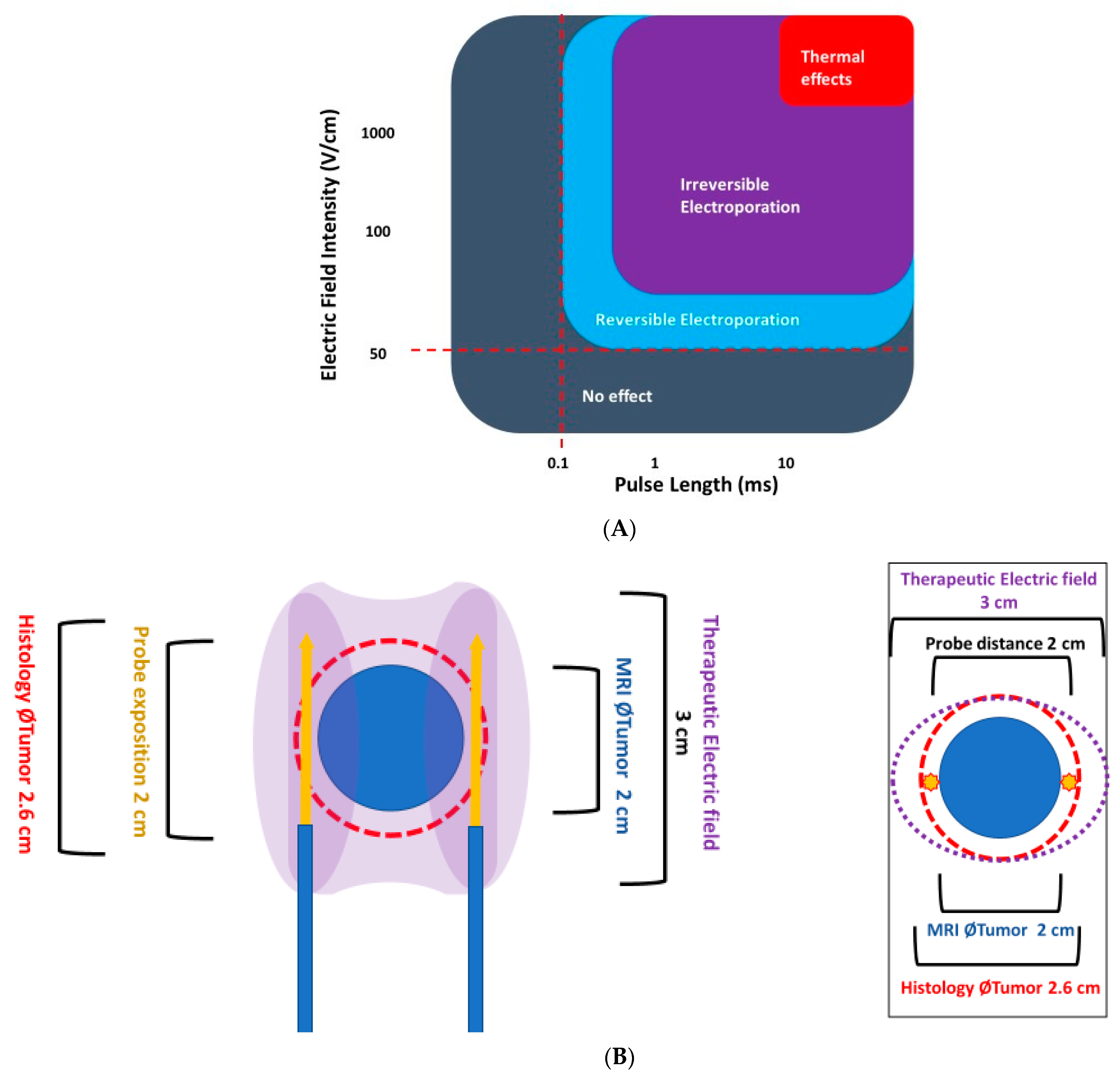Geometric Anatomy Basis For Safe And Effective Focal Ablation Of