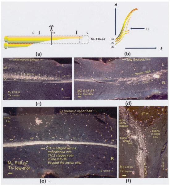 On the Blueprint of the Long Primary Afferent Axons and the Dichotomous ...