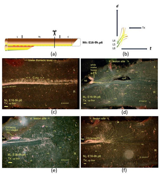 On the Blueprint of the Long Primary Afferent Axons and the Dichotomous ...