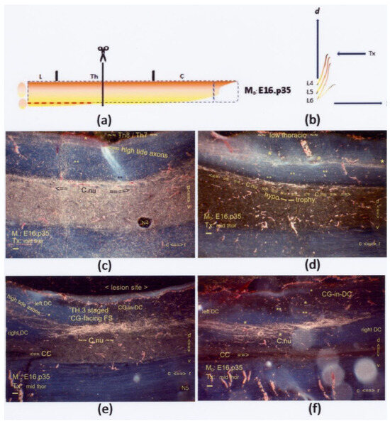 On the Blueprint of the Long Primary Afferent Axons and the Dichotomous ...