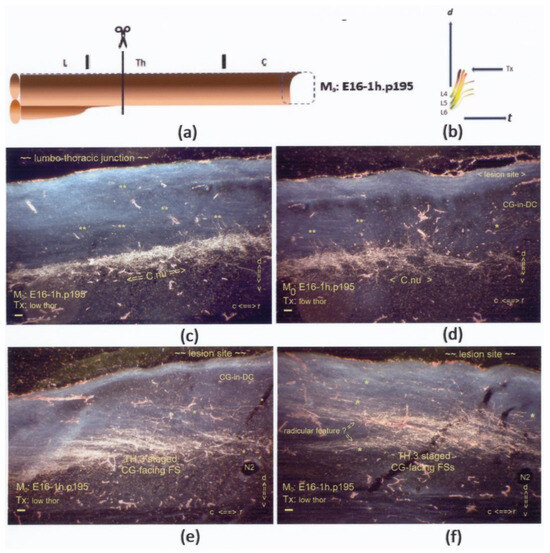 On the Blueprint of the Long Primary Afferent Axons and the Dichotomous ...