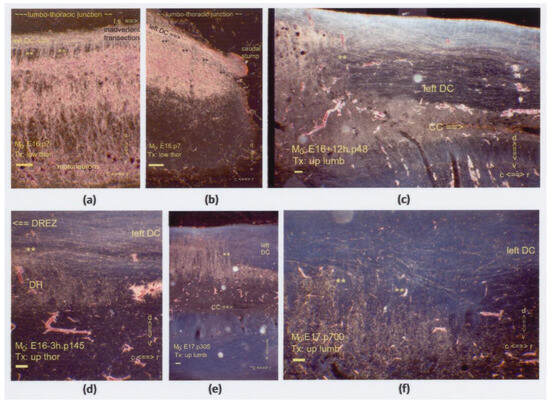 On the Blueprint of the Long Primary Afferent Axons and the Dichotomous ...