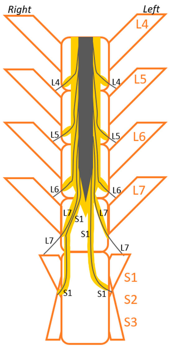 Conjoined Lumbosacral (L7-S1) Nerve Roots in a Dog