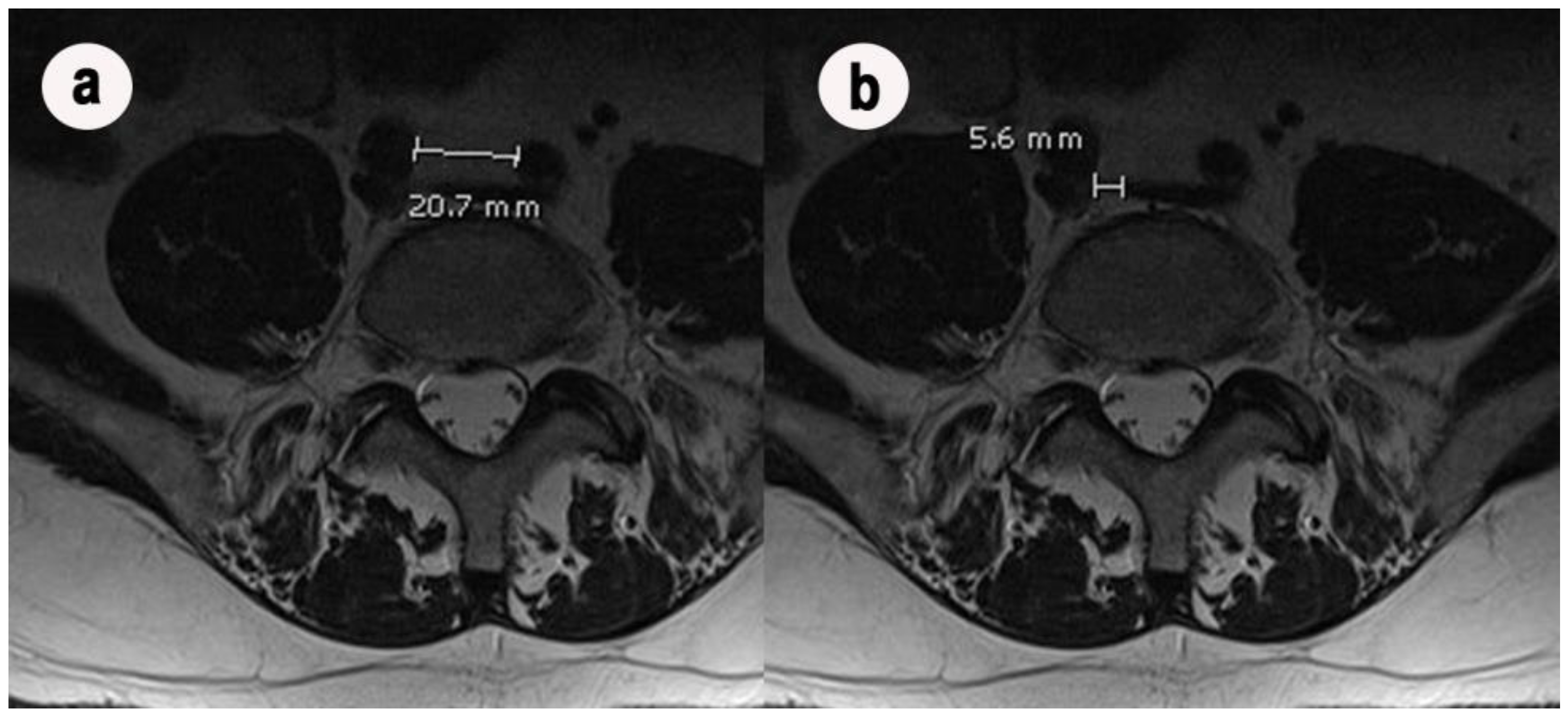 Anatomia | Free Full-Text | The Impact of Patient-Specific Positions on ...