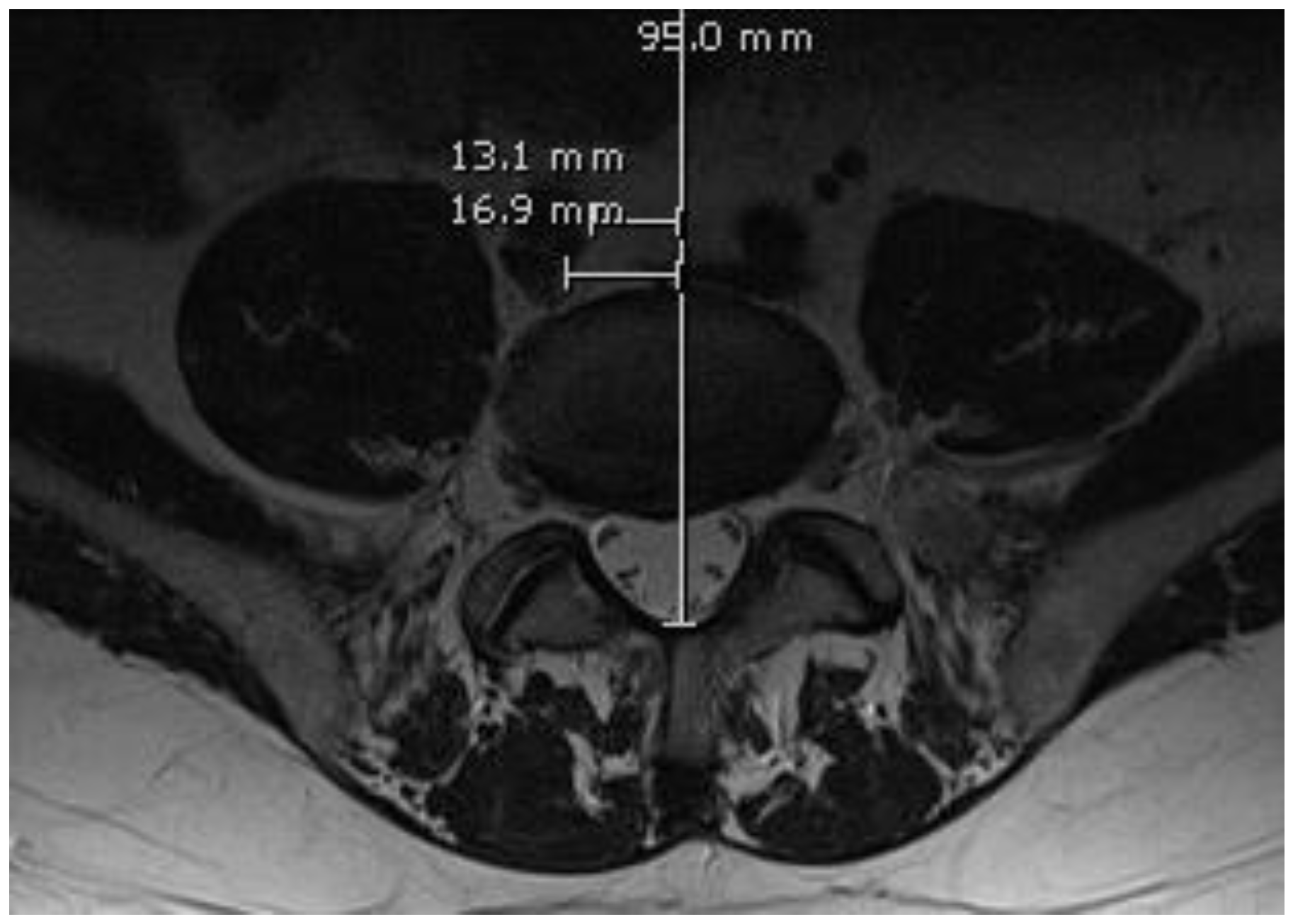 Anatomia | Free Full-Text | The Impact of Patient-Specific Positions on ...