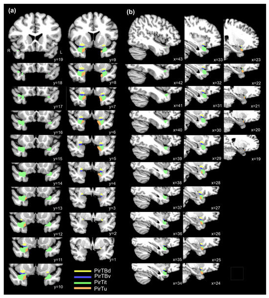 Cytoarchitectonic Analysis and 3D Maps of the Mesial Piriform Region in ...