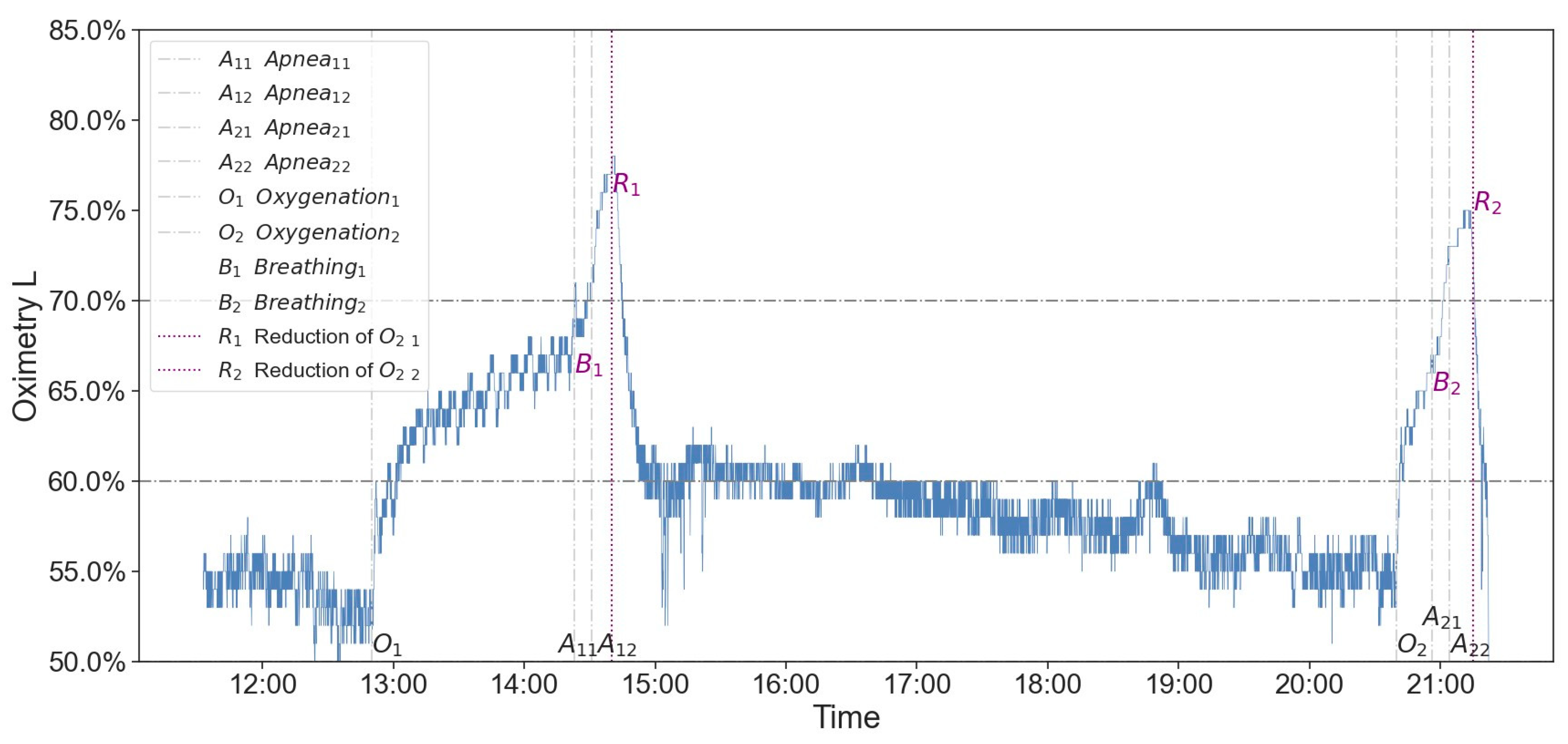 Near-Infrared Spectroscopy (NIRS) in the Assessment of Cerebral Tissue ...