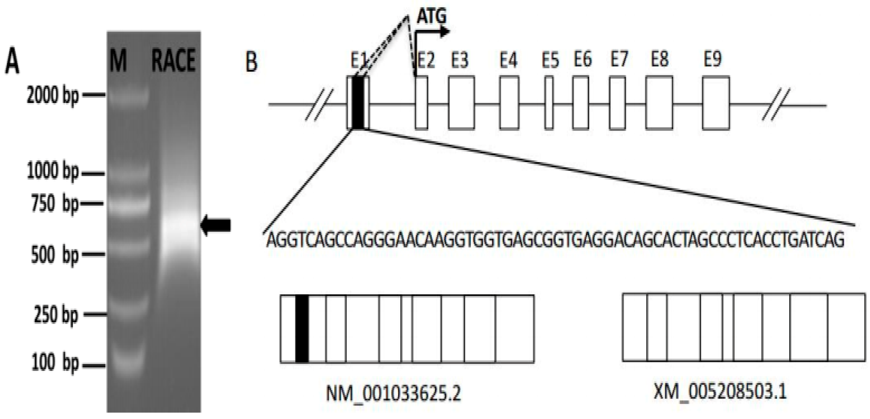 Transcriptional Regulation of the Bovine Fatty Acid Transport Protein 1 ...