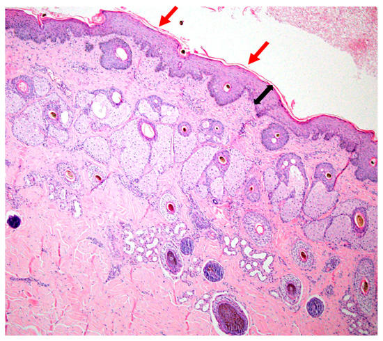 Rare Generalized Form of Fungal Dermatitis in a Horse: Case Report
